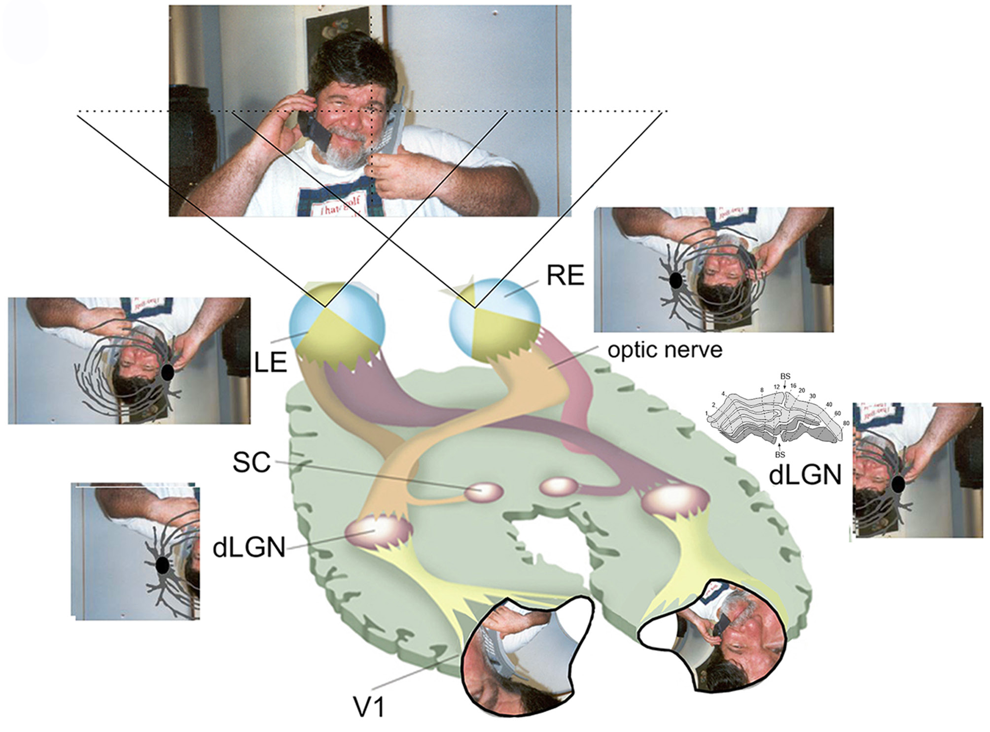 Visual Maps and Visual Perception | Journal of Ophthalmology & Eye Care ...